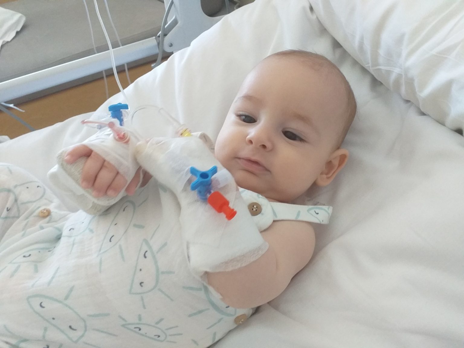 La leucemia linfoblástica aguda del lactante MLL-AF4