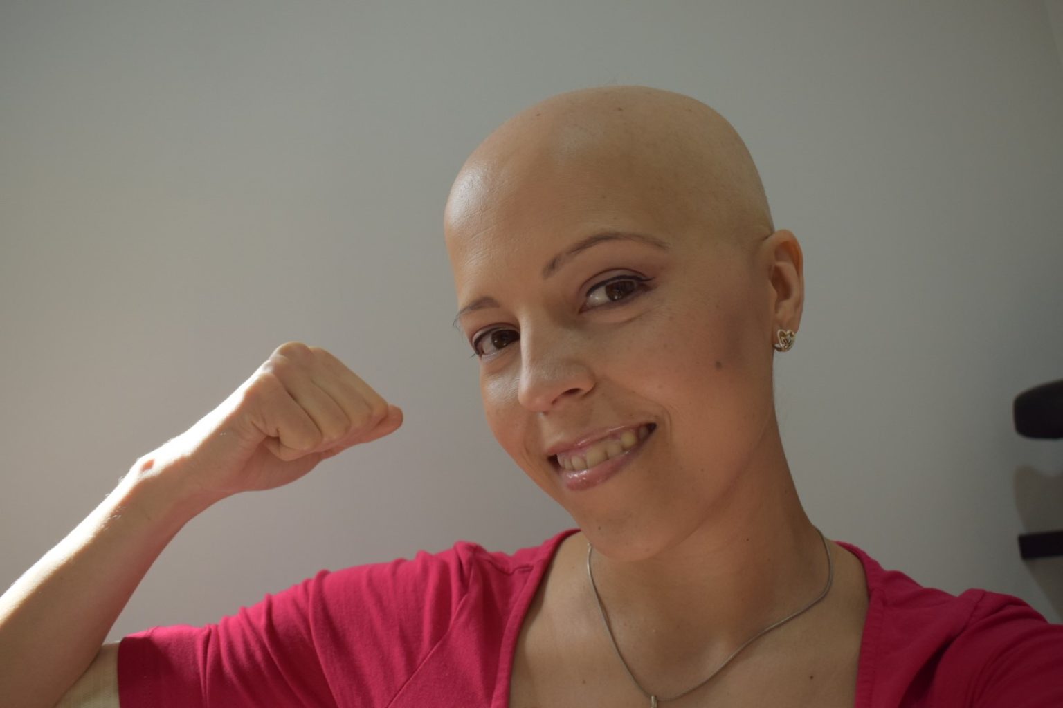 La leucemia linfoblástica aguda en adultos - Fundación Carreras